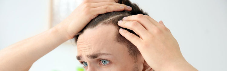 Receding Hairline vs. Maturing Hairline: How to Identify and Address C ...